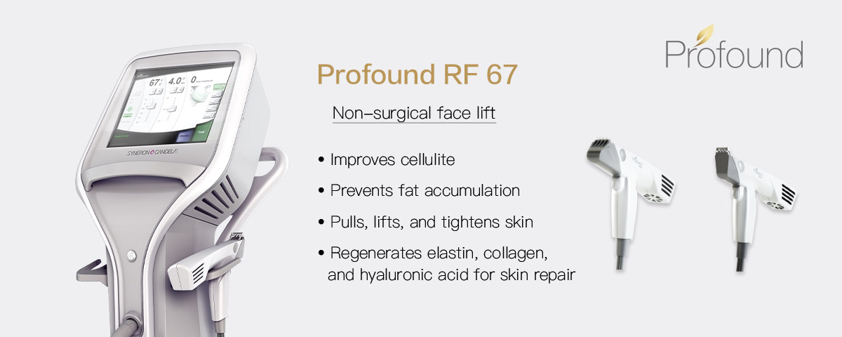 Profound RF - 安珀琢玉 - Le Renouveau